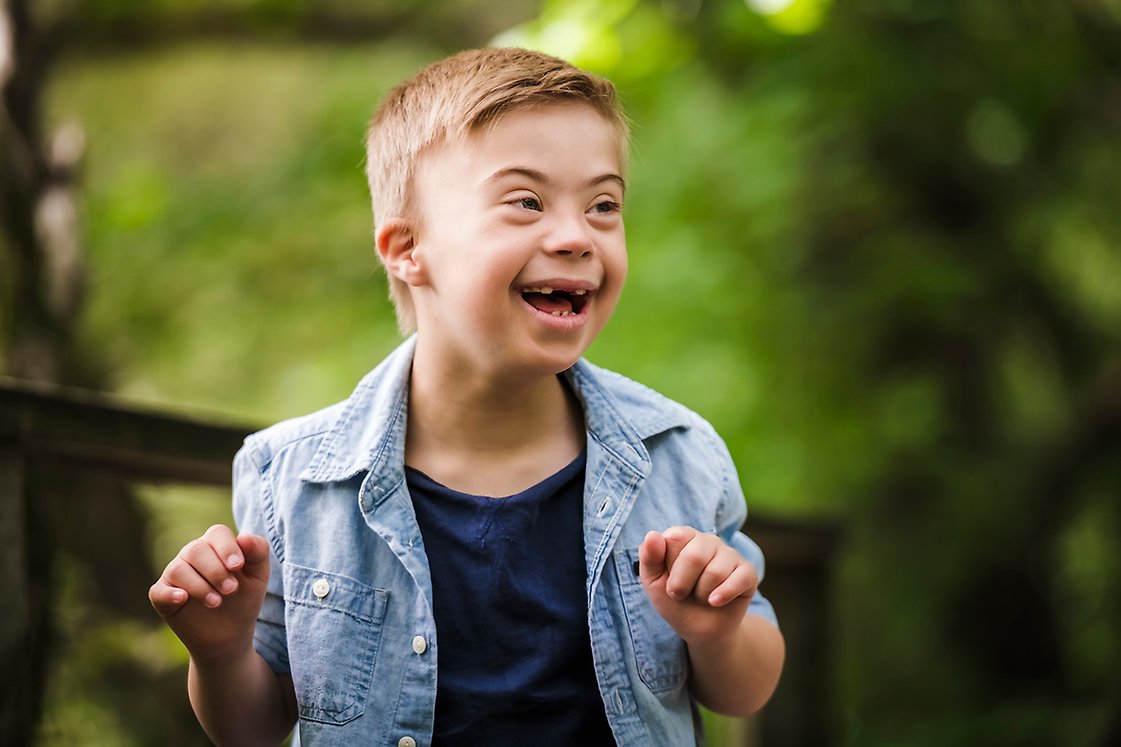 Ökad risk för sämre munhälsa för barn med Downs syndrom - Jönköping University